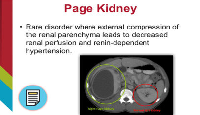 Differential Diagnosis of Radiolucent Pericoronal Lesions | E-Gallery ...