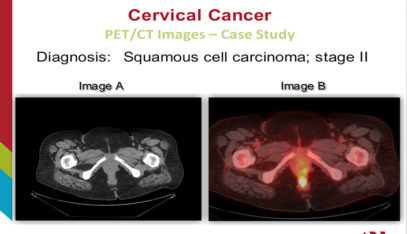 Anatomy of the Female Breast | E-Gallery | University of Nebraska ...