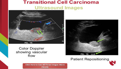 Transitional Cell Carcinoma: A Male Reproductive System Case Study | E ...