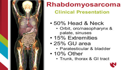 Rhabdomyosarcoma: A Musculoskeletal Pathology Case Study | E-Gallery ...