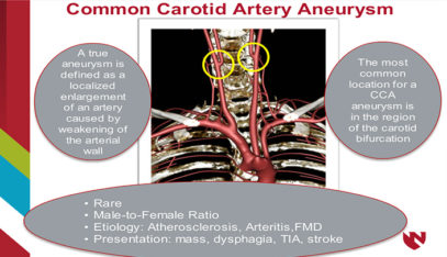 Differential Diagnosis of Radiolucent Pericoronal Lesions | E-Gallery ...