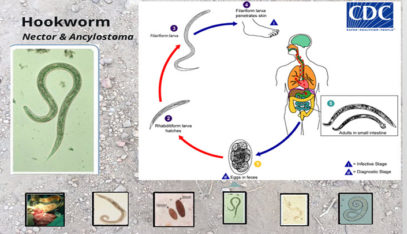 Nematodes | E-Gallery | University of Nebraska Medical Center