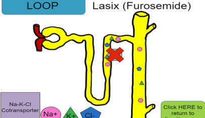 How Diuretics Work | E-Gallery | University of Nebraska Medical Center
