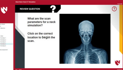 Brain, Neck, and Chest CT Simulation | E-Gallery | University of ...