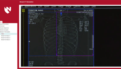 : CT Simulation | E-Gallery | University of Nebraska Medical Center