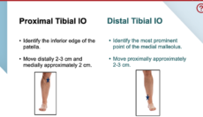 Intraosseous Line Placement | E-Gallery | University of Nebraska ...