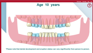Guess my age from dental radiographs | E-Gallery | University of ...