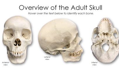 Anatomy of Dental Injections | E-Gallery | University of Nebraska ...