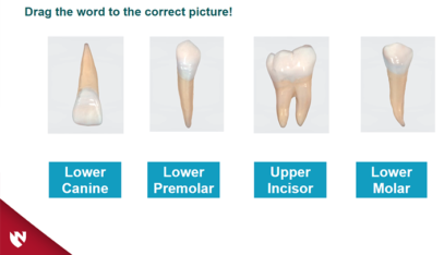 Tooth Identification | E-Gallery | University of Nebraska Medical Center