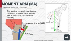 Biomechanics: Torque | E-Gallery | University of Nebraska Medical Center