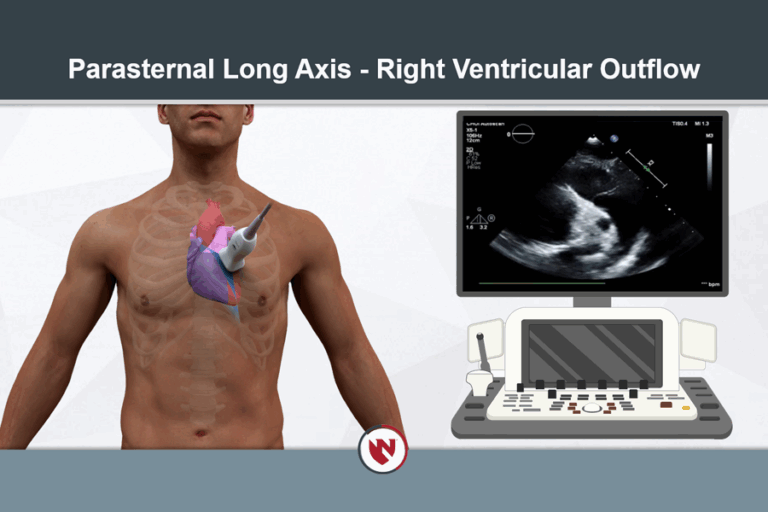 Cardiac Anatomy & Orientation of the 3D Heart Part 2 | E-Gallery ...