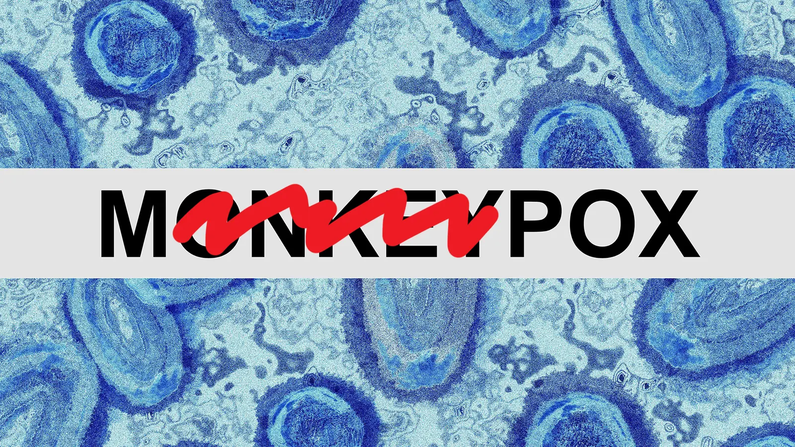The Virus Formerly Known as Monkeypox | The Transmission | University ...