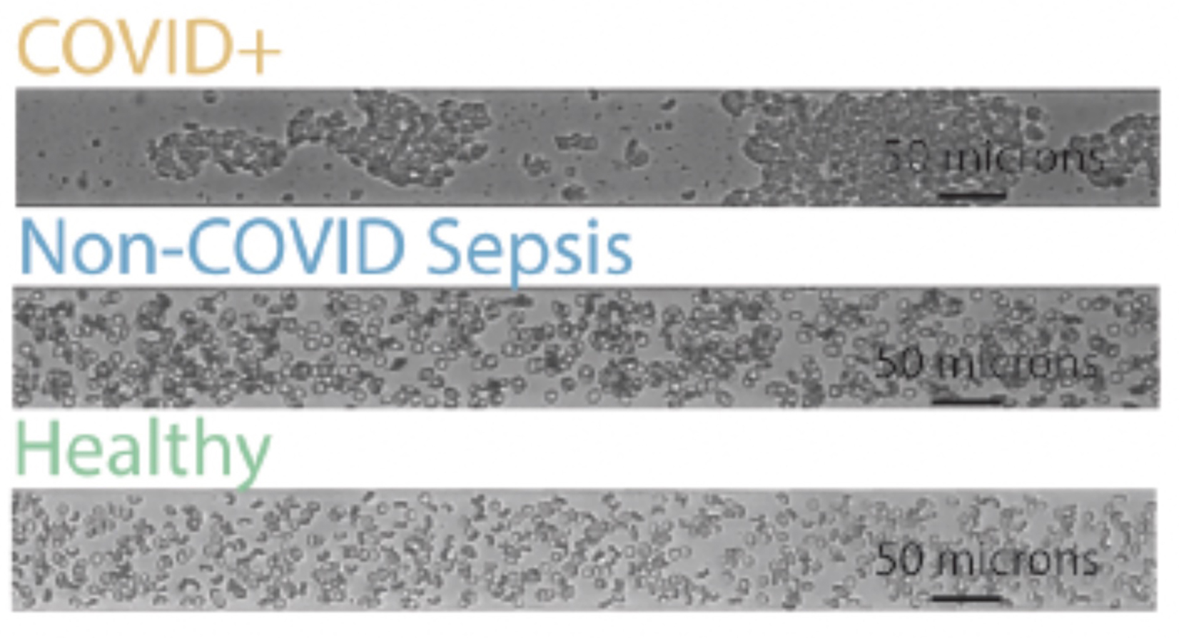 Emory researchers discover key pathway for COVID organ damage in adults ...