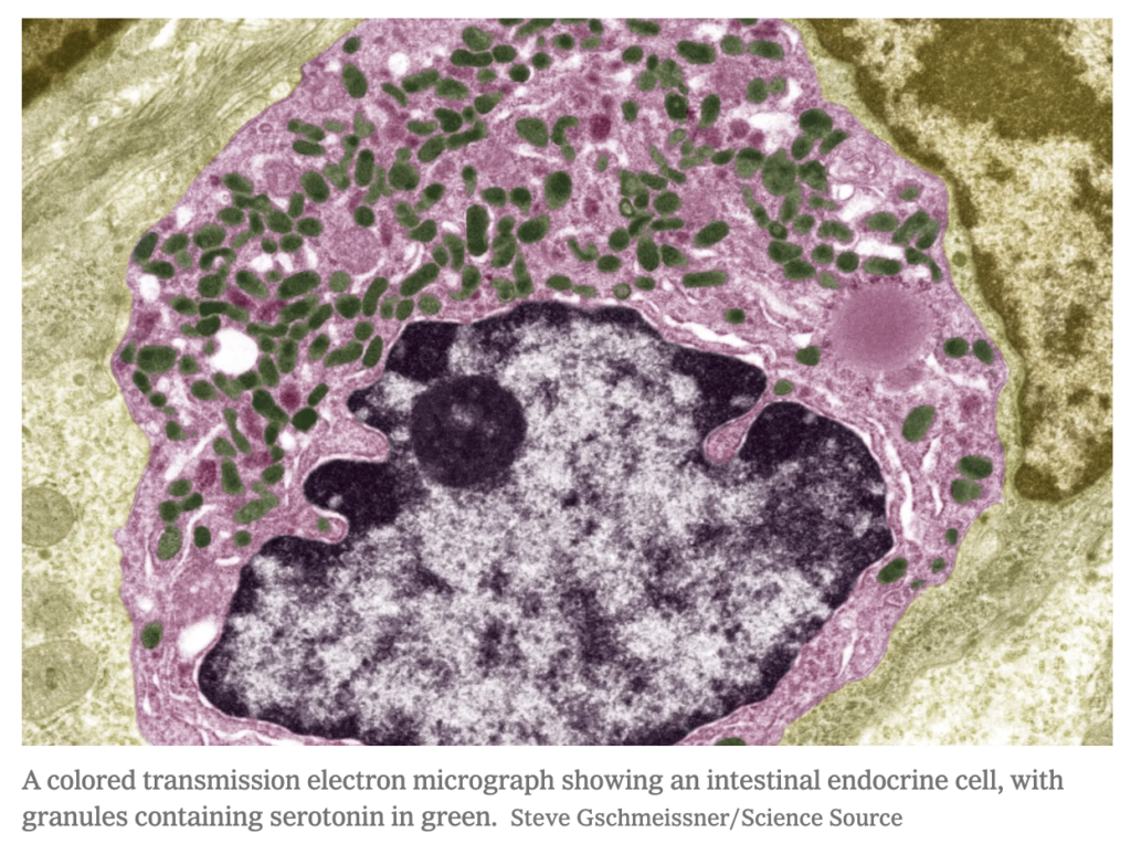 Scientists Offer a New Explanation for Long Covid | The Transmission ...