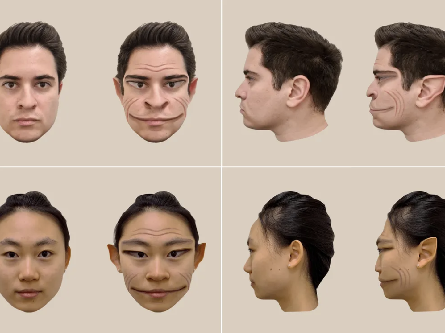 This Extremely Rare Neurological Condition Makes Faces Appear Distorted ...
